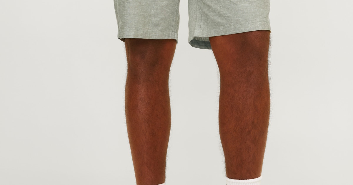 Plus Size Tapered Fit Chino Shorts | Dunkelgrün | Jack & Jones®